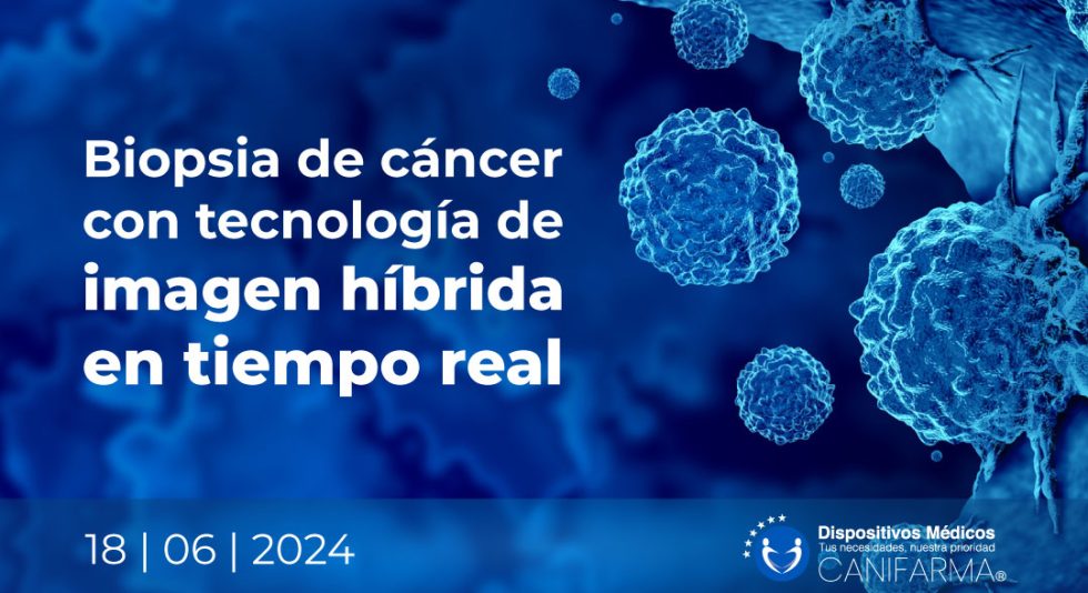 Biopsia de cáncer con tecnología de imagen híbrida en tiempo real ...